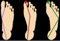 Orthotics for Running - The Runner's Resource